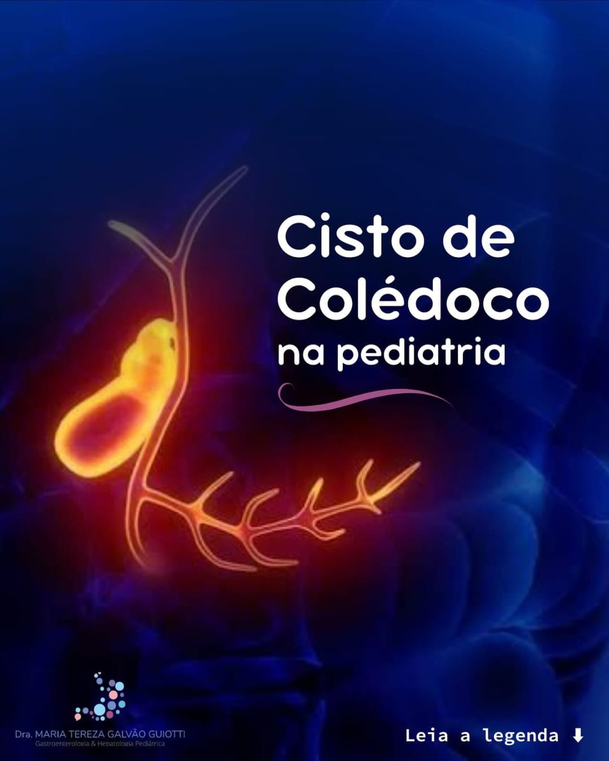Cisto de Colédoco na pediatria - Dra. Maria Tereza Pediatra ...